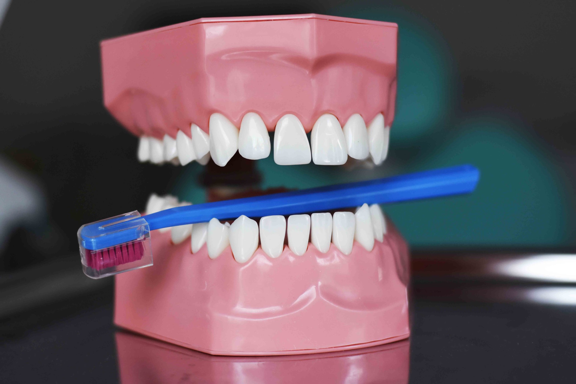 Parodontológia | Dental Center