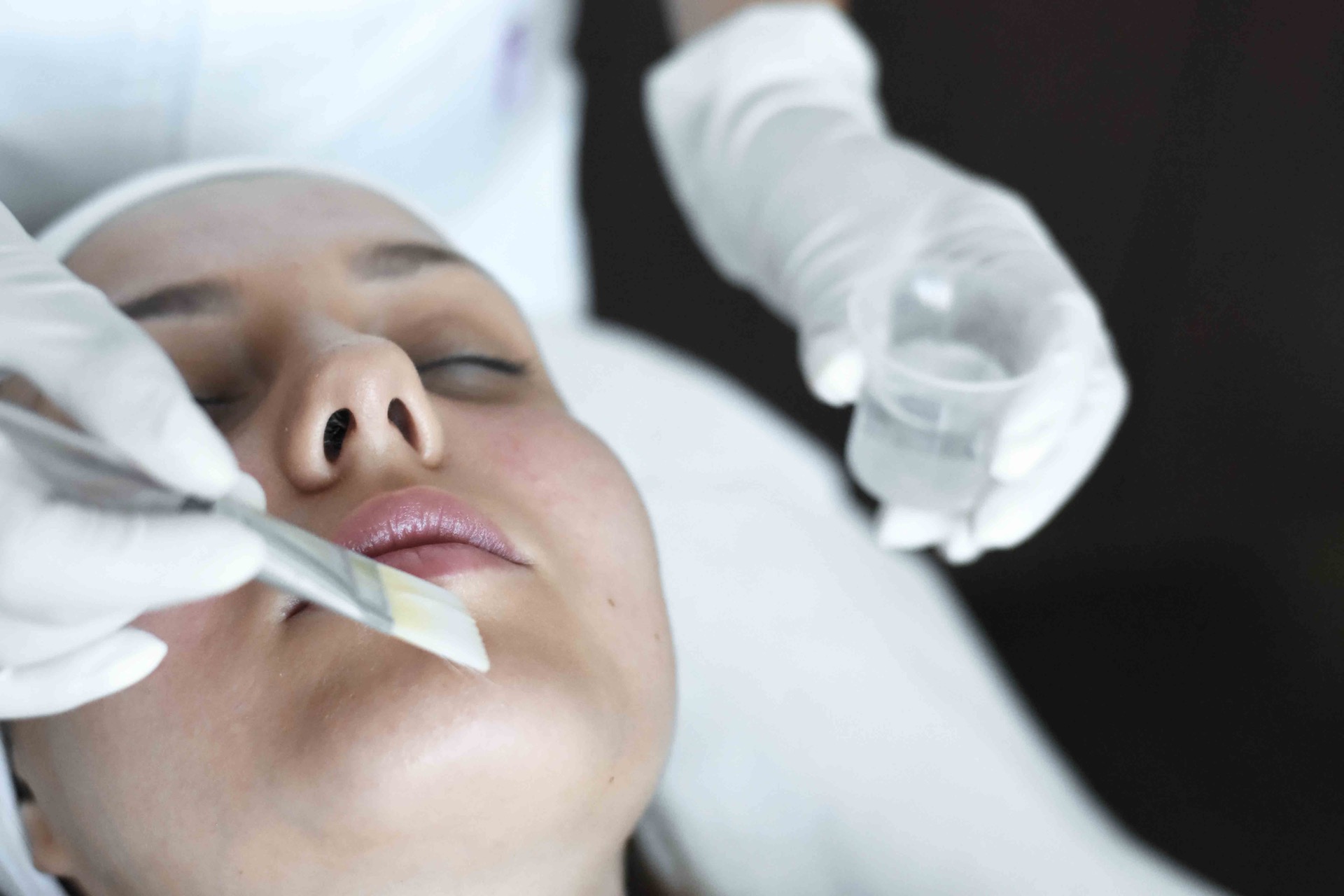 Pigmentácie | Derma Center