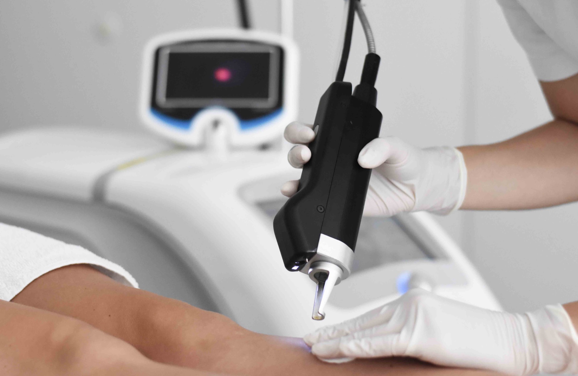 Laser Vascular Therapy | Derma Center