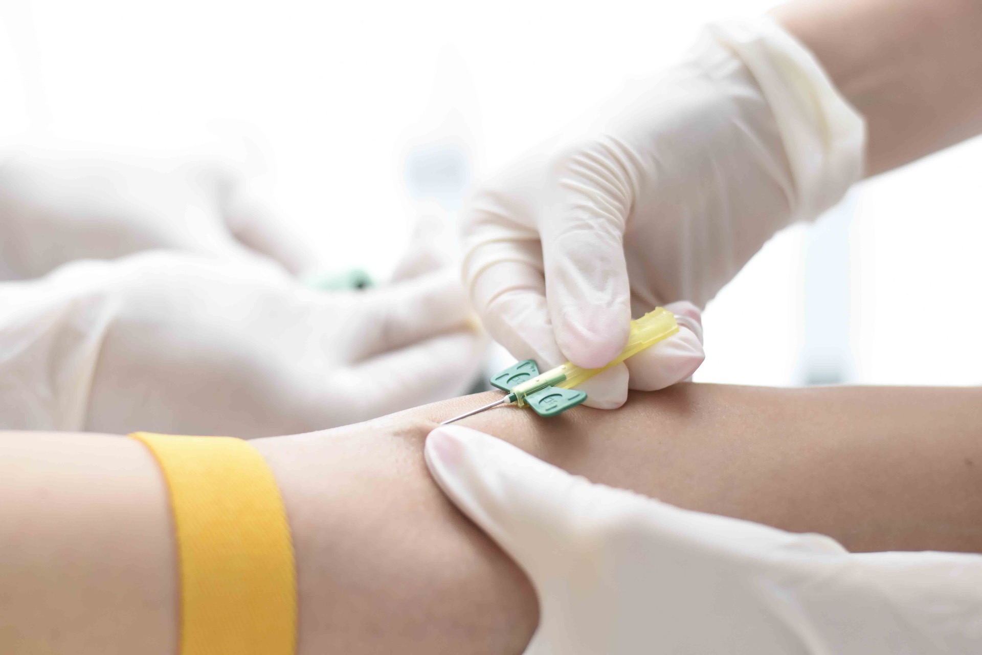 Plasma lifting | Derma Center