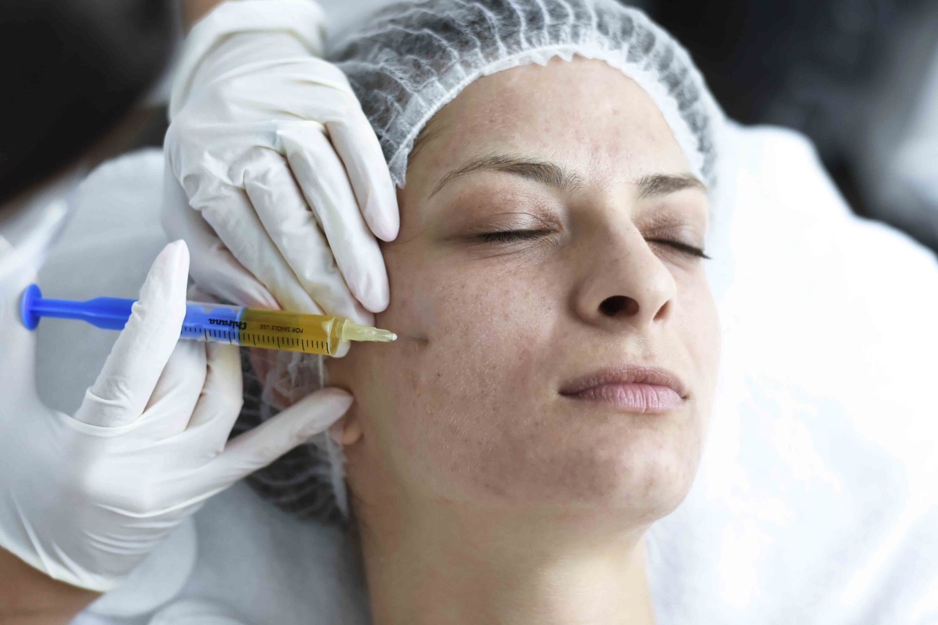 Plasma lifting | Derma Center
