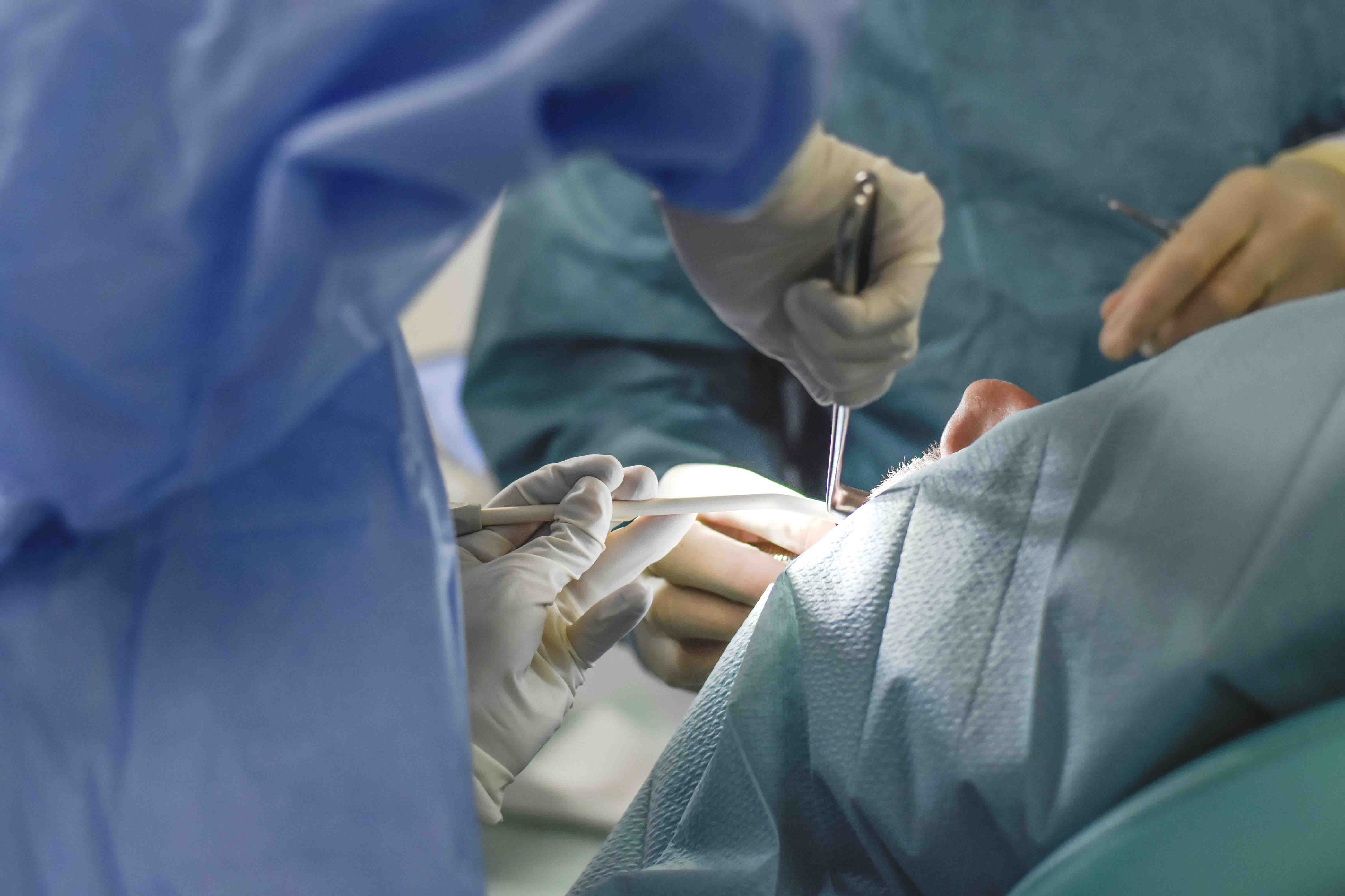 Plastika oroantrálnej komunikácie | Dental Center